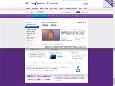 Early Alzheimers Disease Detection System Using Decision Tree Algortihm Ppt