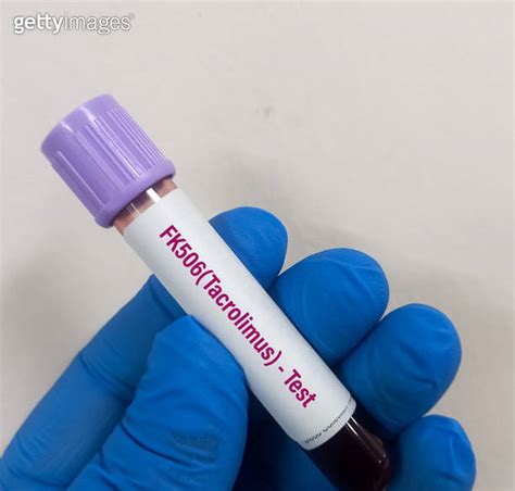 What Is A Tacrolimus Lab Test At Glenn Ledoux Blog