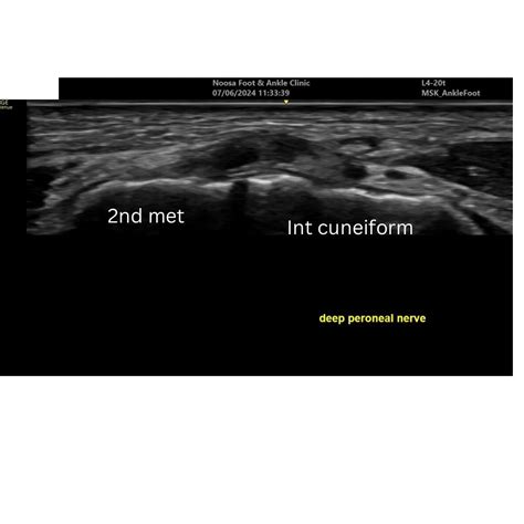 Craig Wanless On Linkedin Interesting Case Today 51 Yo Male Presented