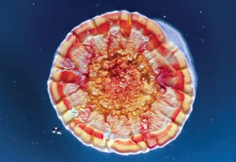 Antibacterial Boom And Bust