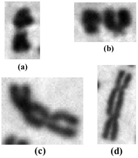 Chromosome Cluster Misclassified As Single Chromosome By The Proposed