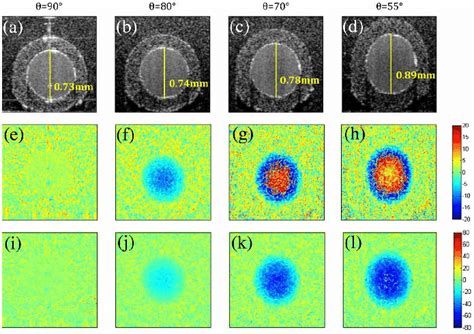 Doppler Angle Measurement And Absolute Flow Velocity Calculation In The Download Scientific