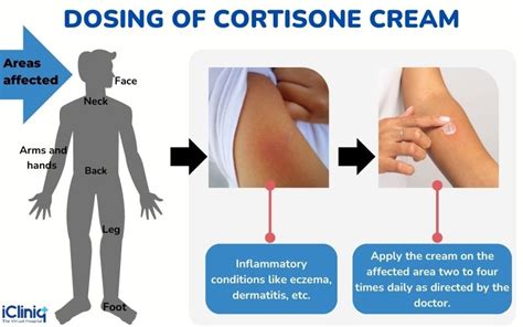 What Is Cortisone Cream Used For