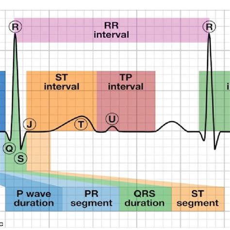 Ecg Graphical Illustration Of Sample Signal Indicating All The