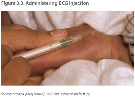 Bleb Intradermal Injection