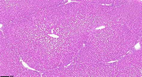I Cannot Tell Where The Hepatic Lobule Borders Are