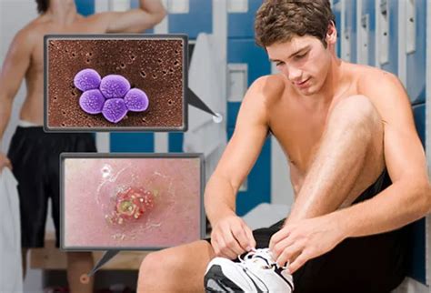 Preventing Mrsa Defense Soap