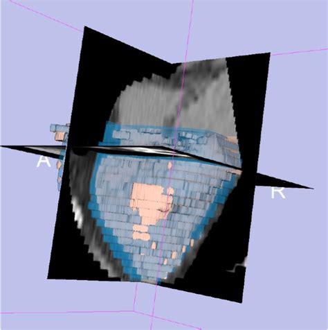 3d reconstruction of the segmented volume download scientific diagram