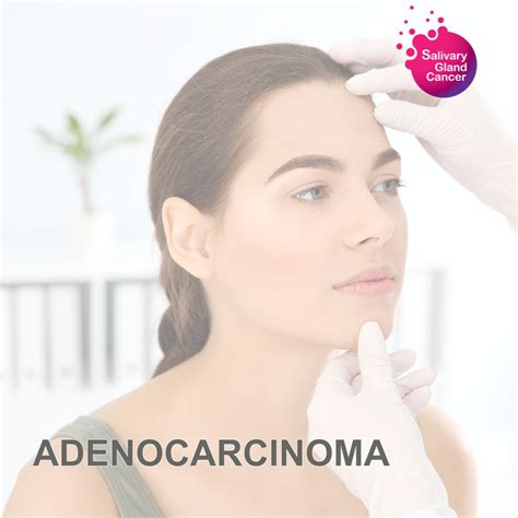 Adenoid Cystic Carcinoma Acc Salivary Gland Cancer Uk