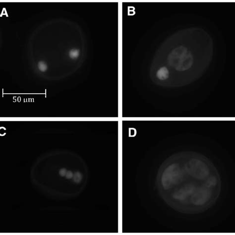 Comparison Of Binucleated Microspore With Small Nuclei A Binucleated