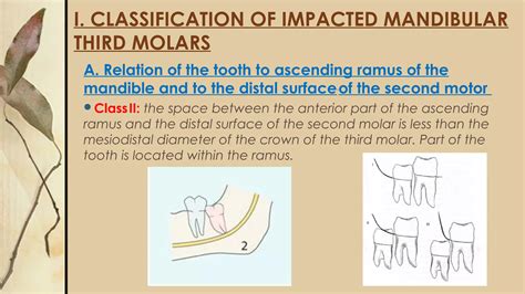 Surgical Removal Of Impacted Teeth Ppt