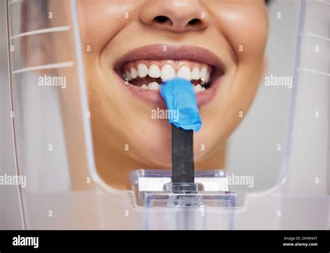 Person Dental Or X Ray Machine At Dentist Appointment With Calm Smile