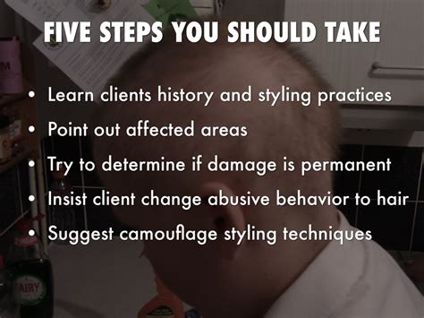 Diseases And Disorders Of The Scalp By Janiqua Cooper