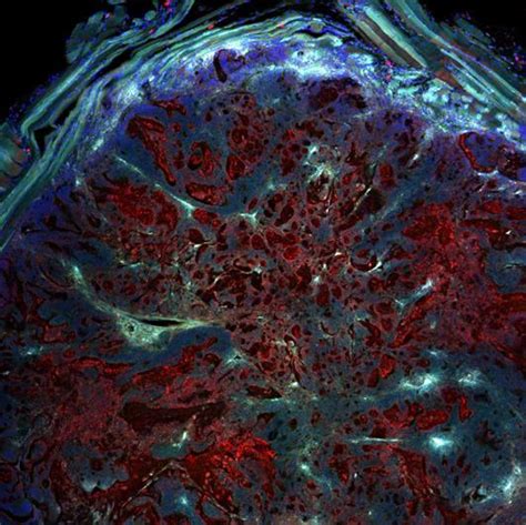 Amsbio Reproduces Cancer Cells For Research Scientist Live