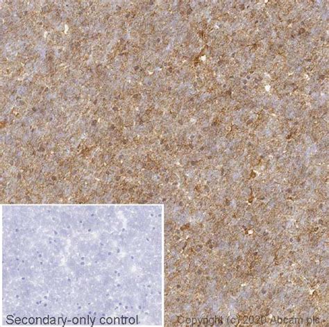 Anti S100 Beta Antibody Astrocyte Marker Ab52642 Danaher Life