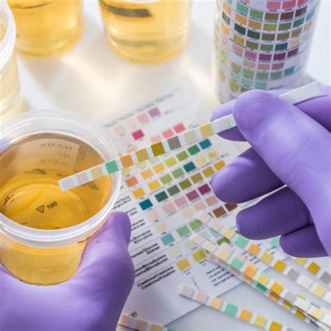 Soil Indicator Ph Tester Strips Tester Strips