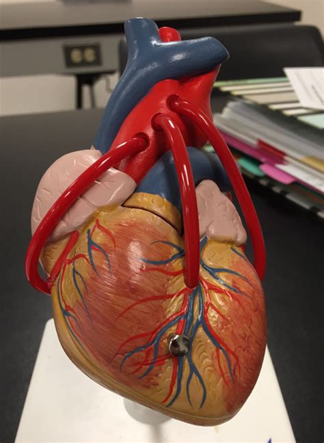 Heart Bypass Model Triple Bypass Diagram Quizlet