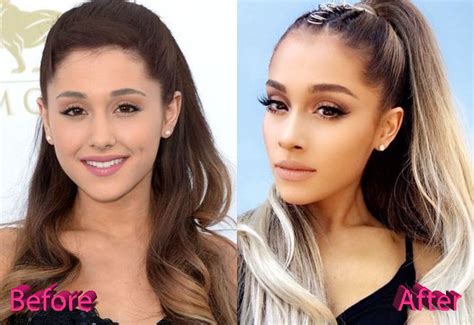 Ariana Grande Plastica No Nariz Antes E Depois