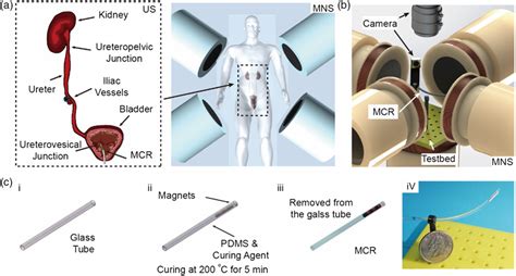 A Schematic Of The Urinary System And An Mns For Rirs Rirs Is
