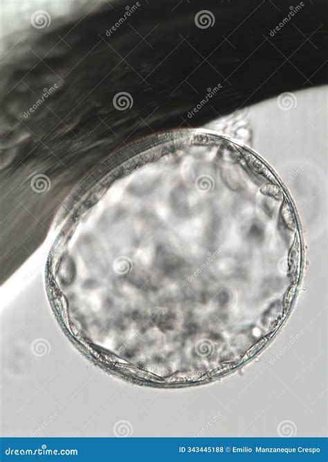 Hatched Human Blastocyst Grade Ba On The Fifth Day Of Development