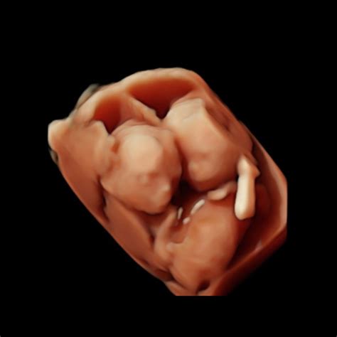 Gender And Wellbeing Pregnancy Scan Southampton Firstsight Scans