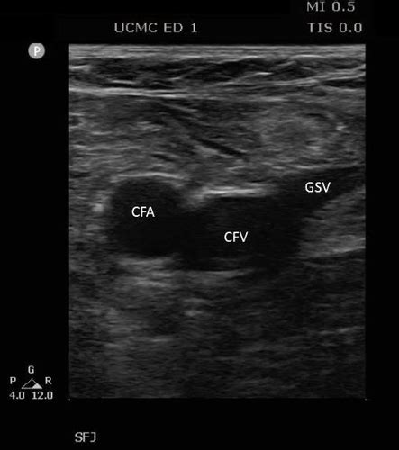Venous Test 1 Flashcards Quizlet