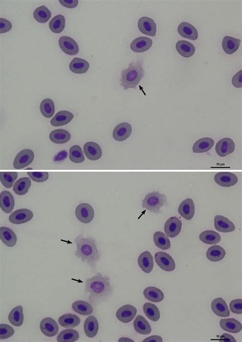 Haemolysis Of Common Carp Red Blood Cells Haemolysed Erythrocytes Are