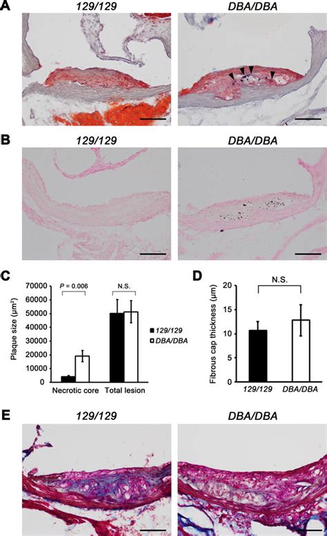 The Dba 2j Haplotype On Distal Chromosome 2 Reduces Mertk Expression