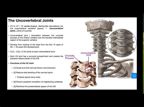 Uncovertebral Joint Hypertrophy Epos™
