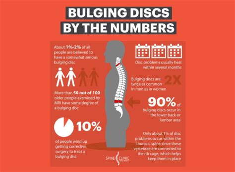Bulging Disc Ketahui Gejala Penyebab And Cara Penanganannya