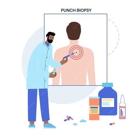 Premium Vector Punch Biopsy Procedure