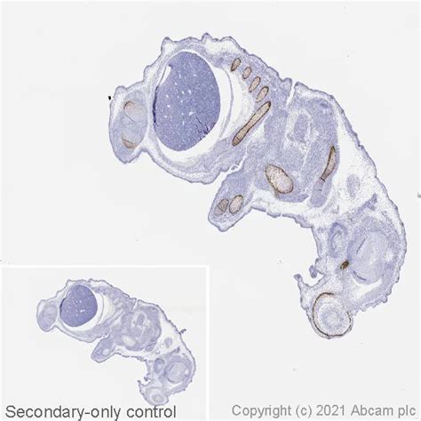 Anti Sp7 Osterix Antibody Epr21034 Ab209484 Abcam