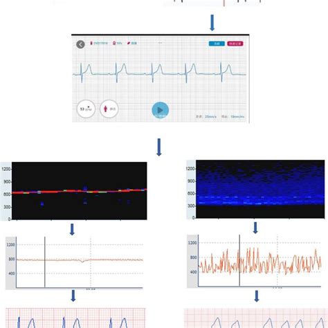 Work Flow Of Portable Long Time Single Lead Ecg Monitor And Ecglab