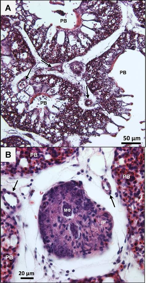 Photomicrographs Of A Plexiform Lesion In The Lung Of A 1 Week Old Download Scientific Diagram