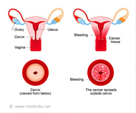 Understanding Your Cervix A Comprehensive Guide