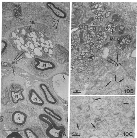 Electron Micrographs Of Sections Of Distal Rat Sciatic Nerve Fixed 28 D