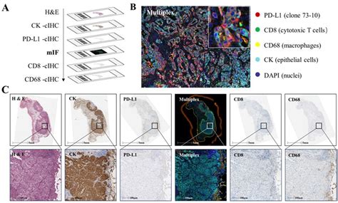 Ultivue On Linkedin Biomarkers Spatialbiology Digitalpathology Precisionmedicine