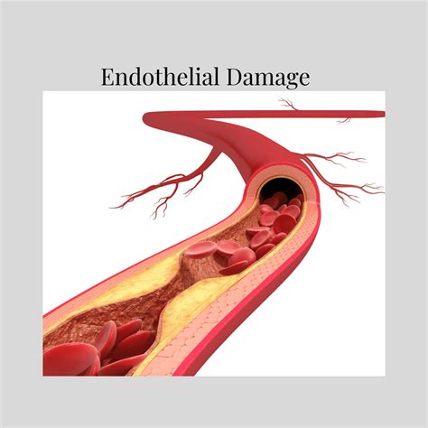 Endothelial Damage Why You Should Be Concerned Especially Now