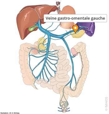 Veine Gastro Omentale Gauche E Anatomy Imaios