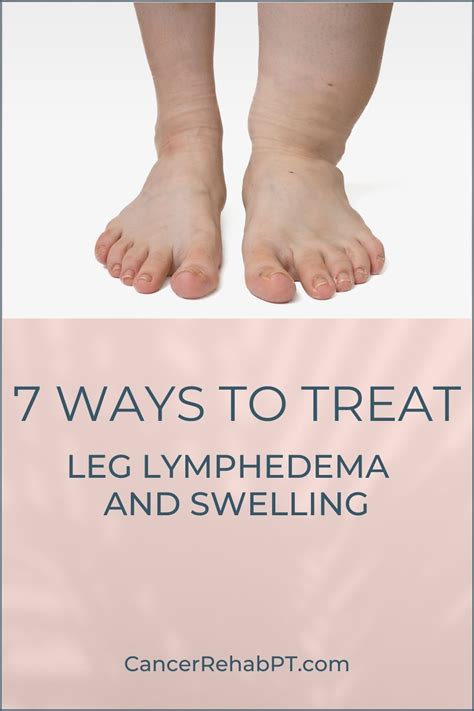 Lymphedema Treatment Artofit