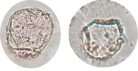 Globular Stage The Scale Bar Represents 01 Mm Download Scientific