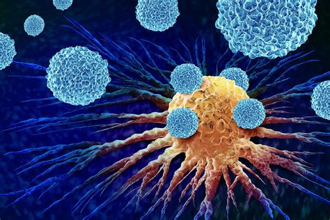 New Til Therapy In Use At Siteman Cancer Center