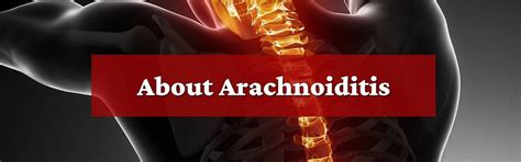 About Arachnoiditis Acmcrn