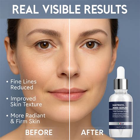 Mua Matrixyl 3000 Total Package Serum With Hyaluronic Acid Argireline