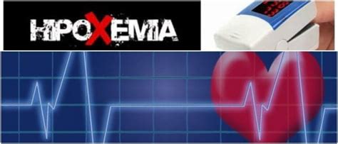 Hipoxemia Tipos Causas Síntomas Diagnóstico Diferencias