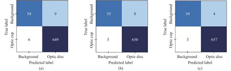 glaucoma detection with retinal fundus images using segmentation and