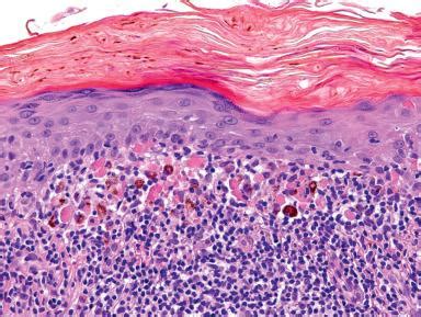 Dermatoses Clinical Tree