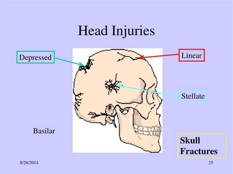 Ppt Trauma Powerpoint Presentation Free Download Id3579996