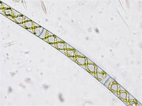 Spirogyra Under Microscope 400x Arthrospira Platensis At Optical