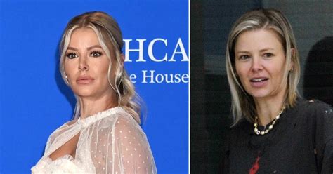 Ariana Madix Goes Makeup Free After Confessing To Cosmetic Procedures